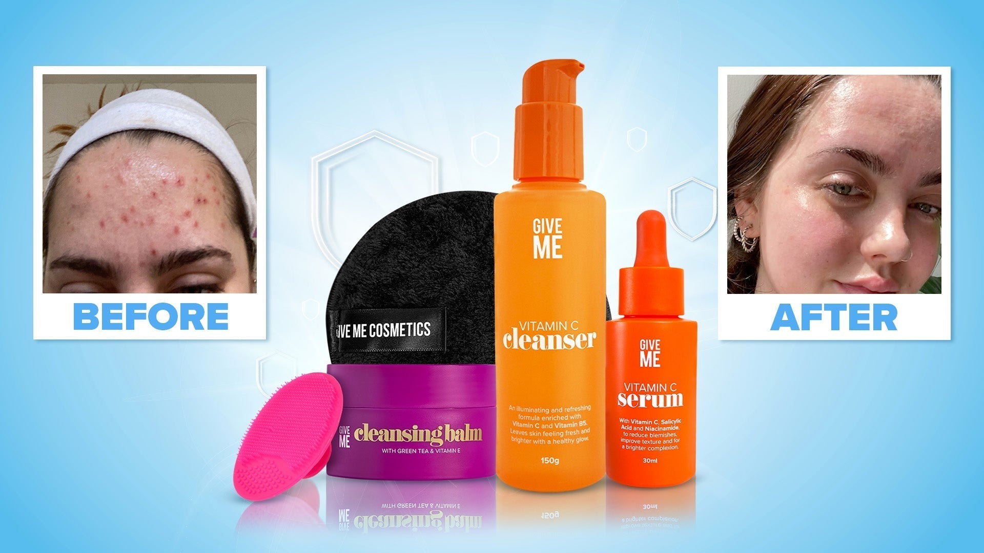 Fight your acne today! – Give Me Cosmetics